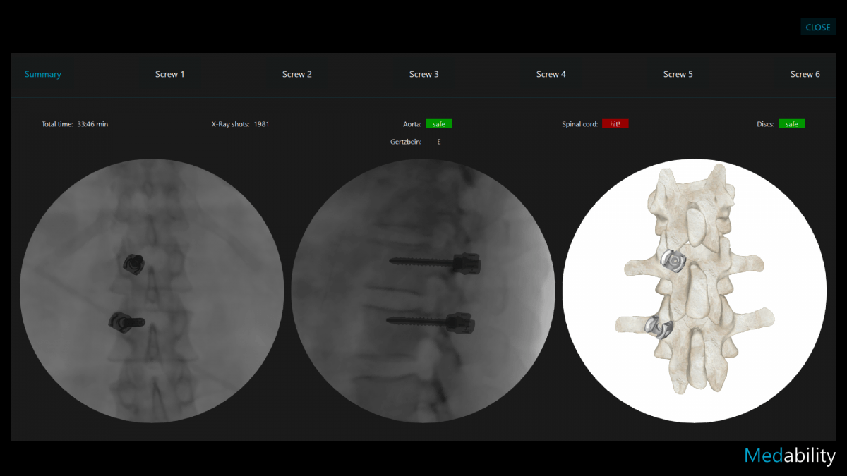 SimBone – Medability